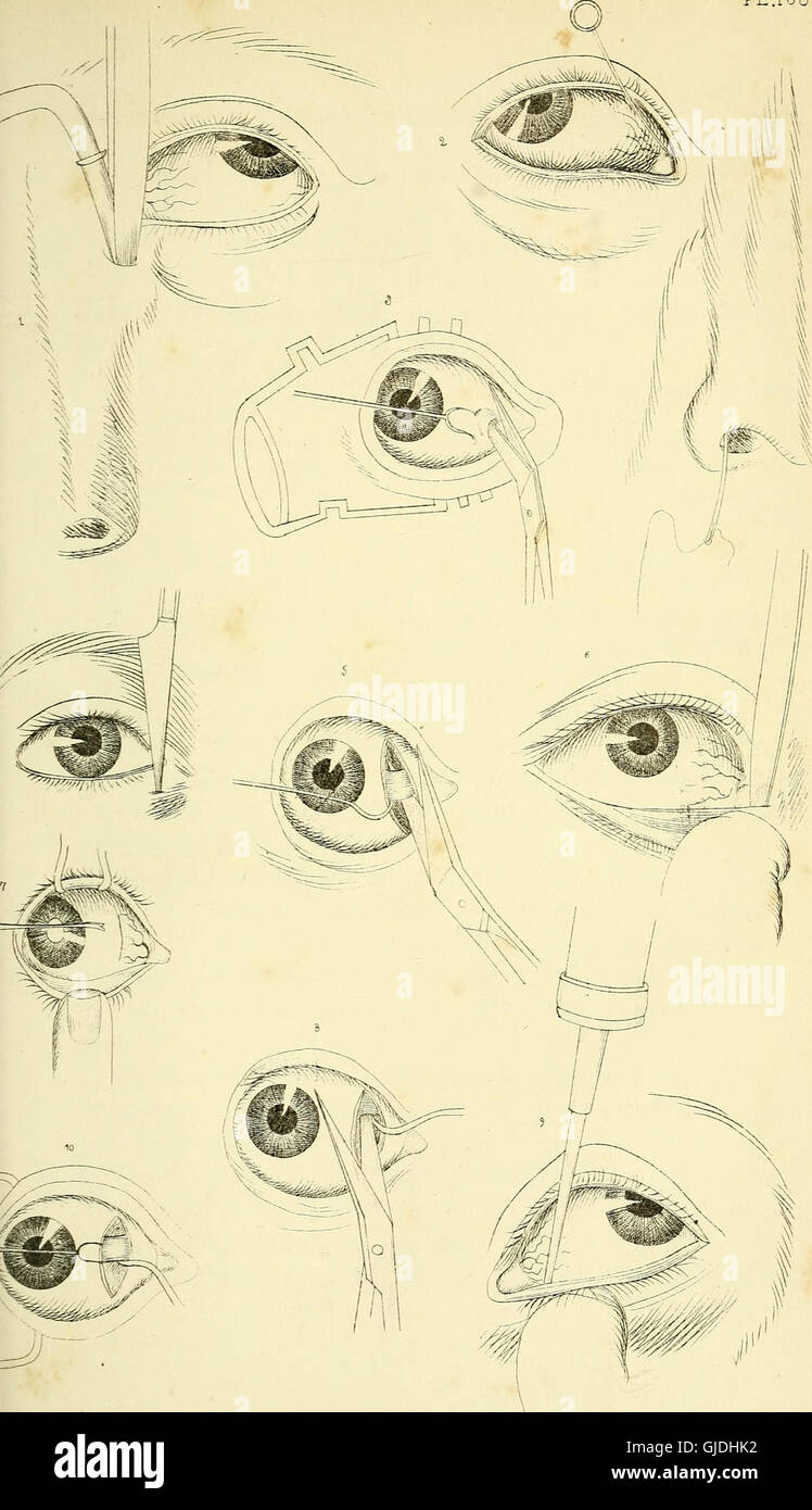 This 1852 work on operative surgery includes over 1,900 engravings and ...