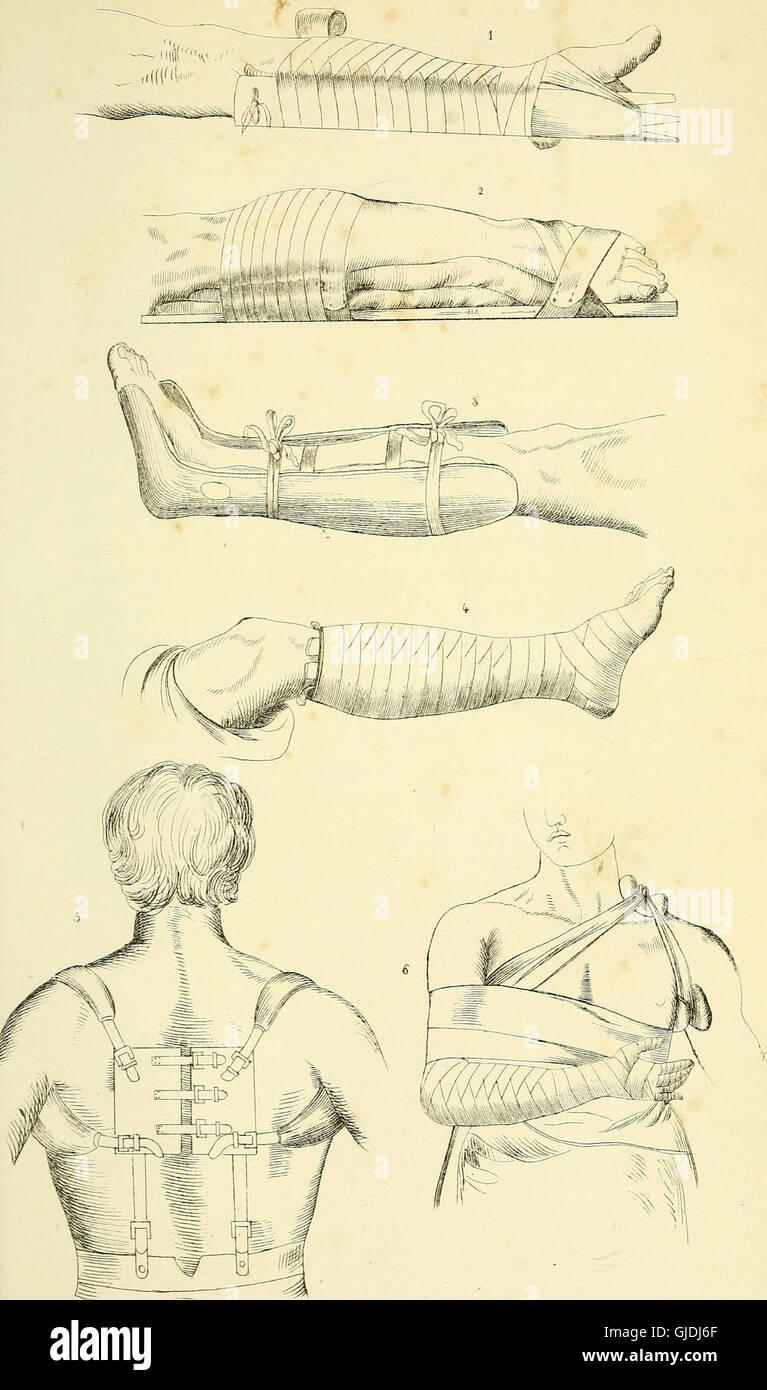 This work presents detailed engravings and drawings of surgical ...