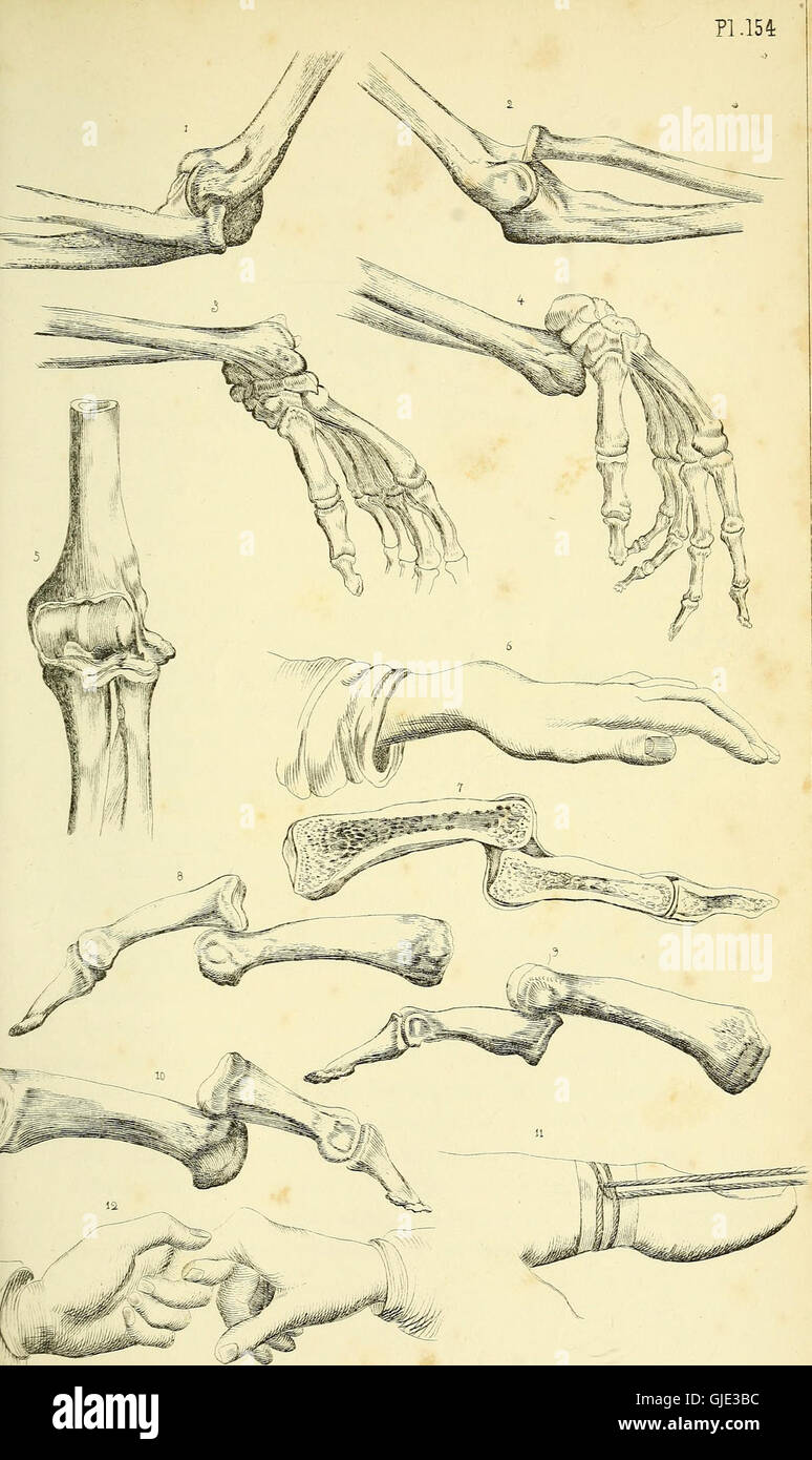 This comprehensive surgical reference features over 1900 engravings and ...