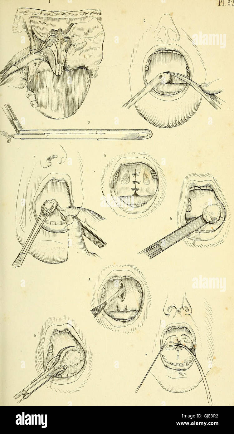 This 1852 work offers a comprehensive guide to operative surgery ...