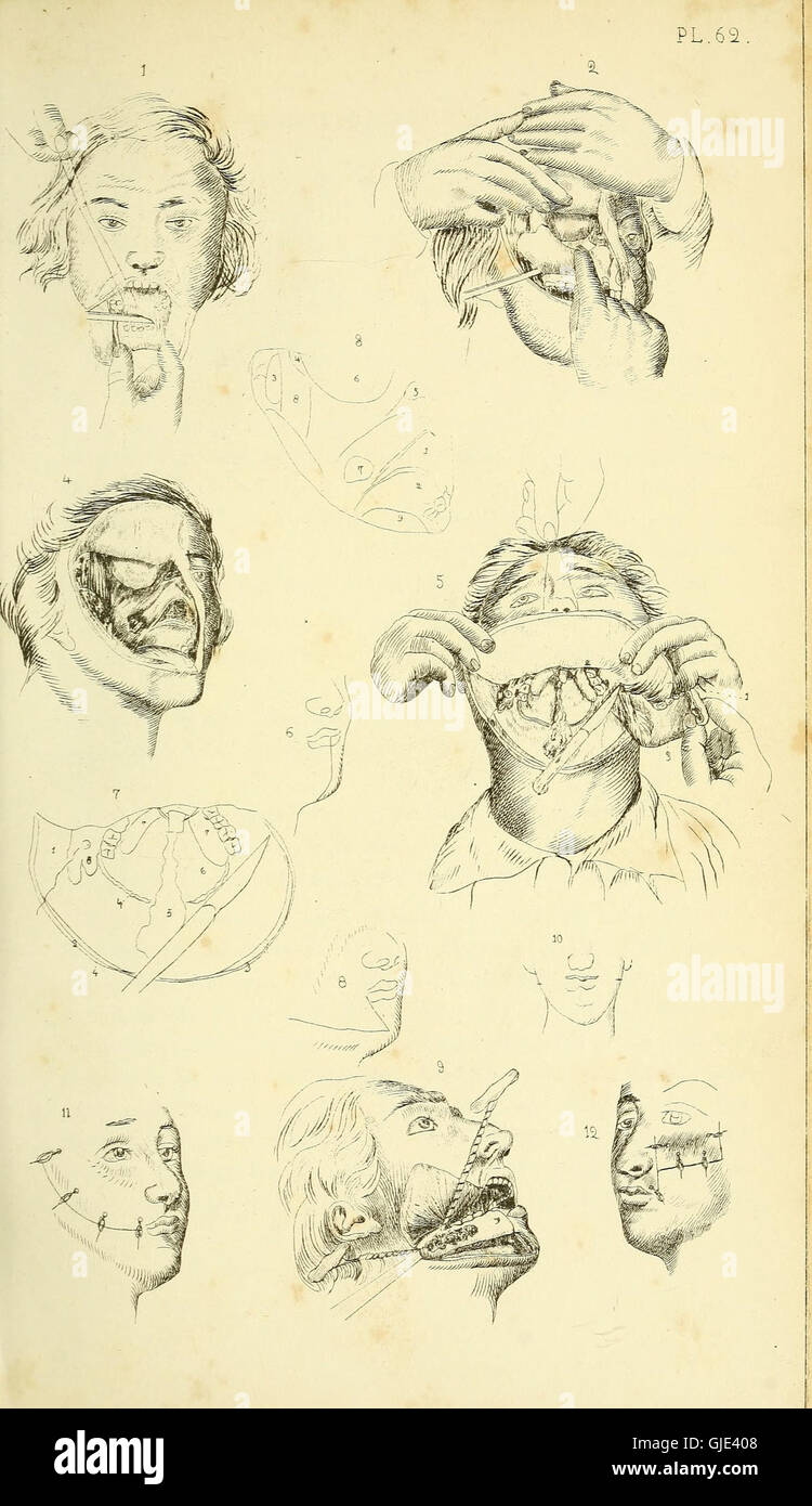 This work on operative surgery includes over 1,900 engravings and ...