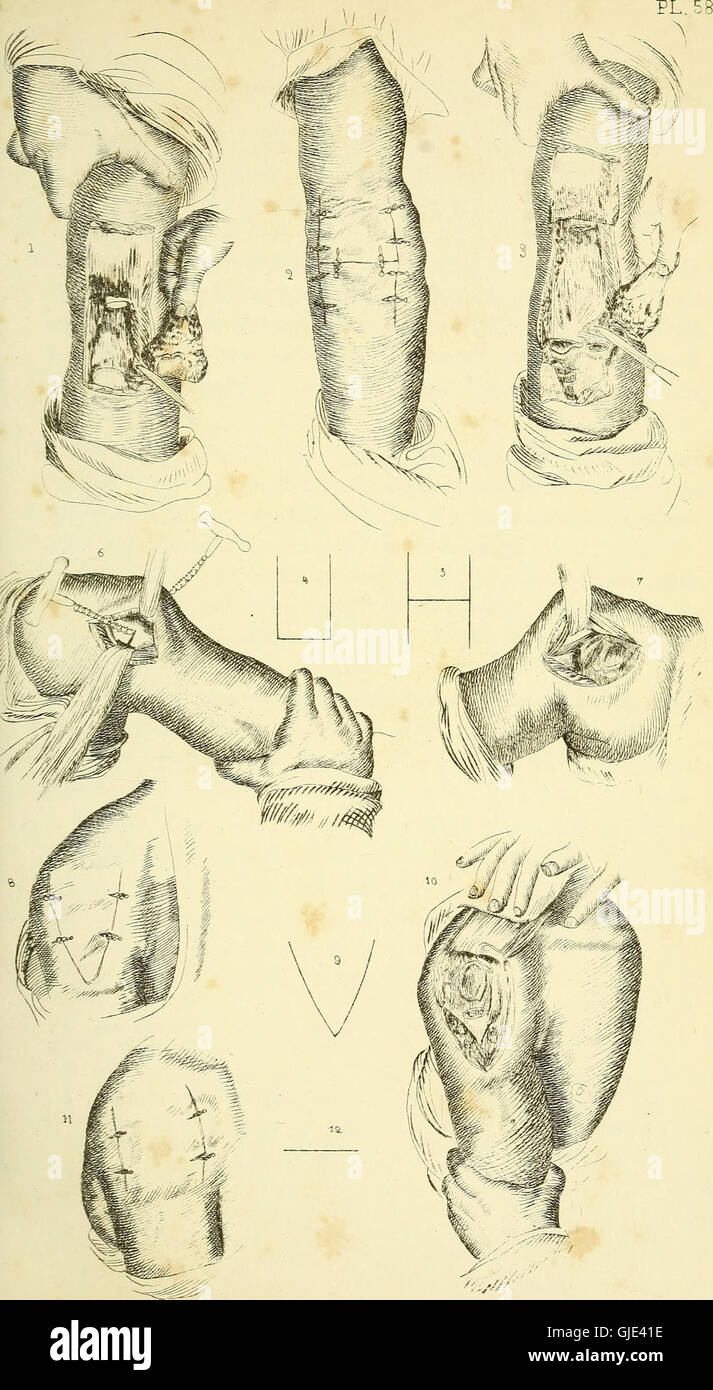 This illustrated surgical reference provides detailed engravings of ...