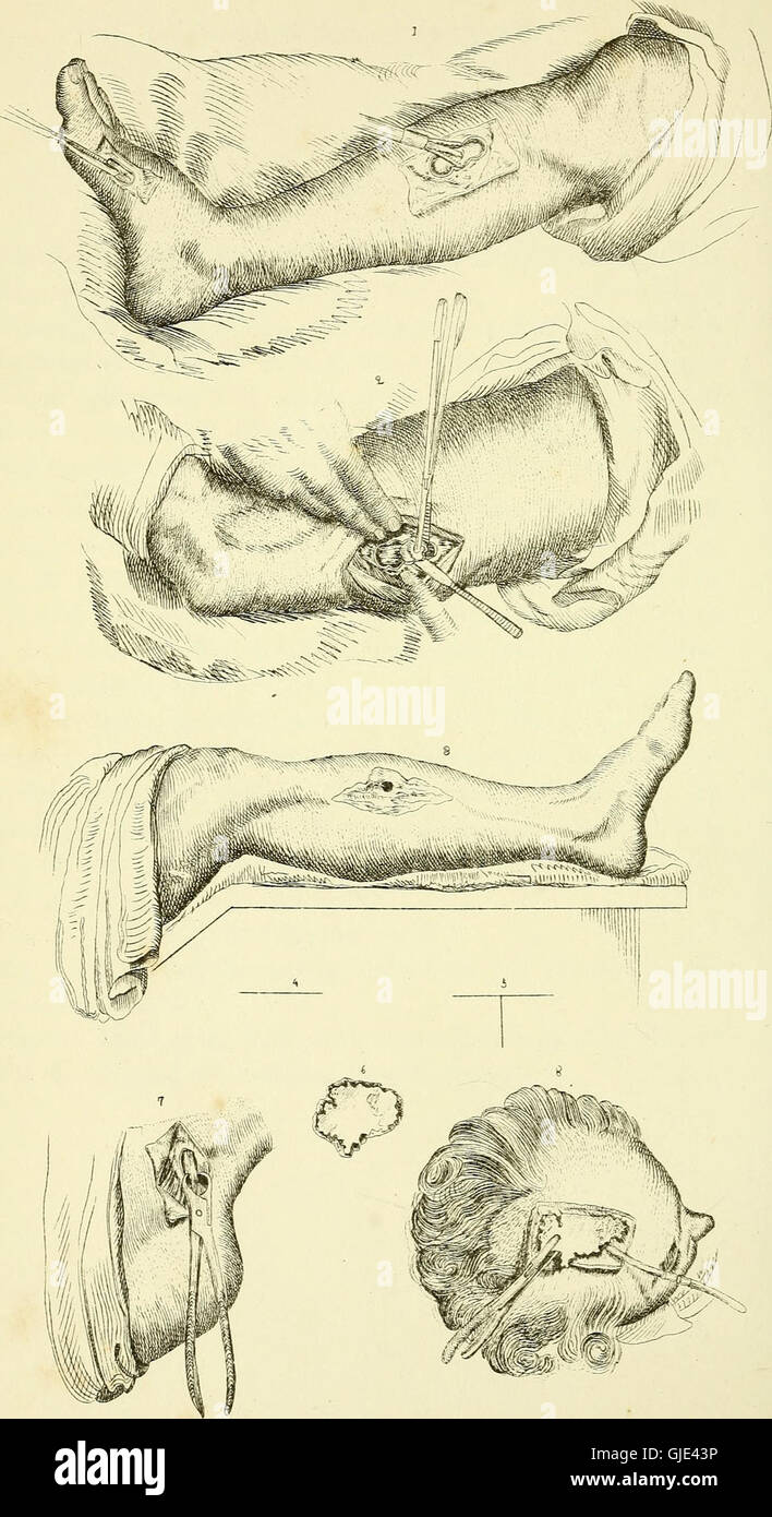 A comprehensive surgery reference featuring over 1,900 engravings ...