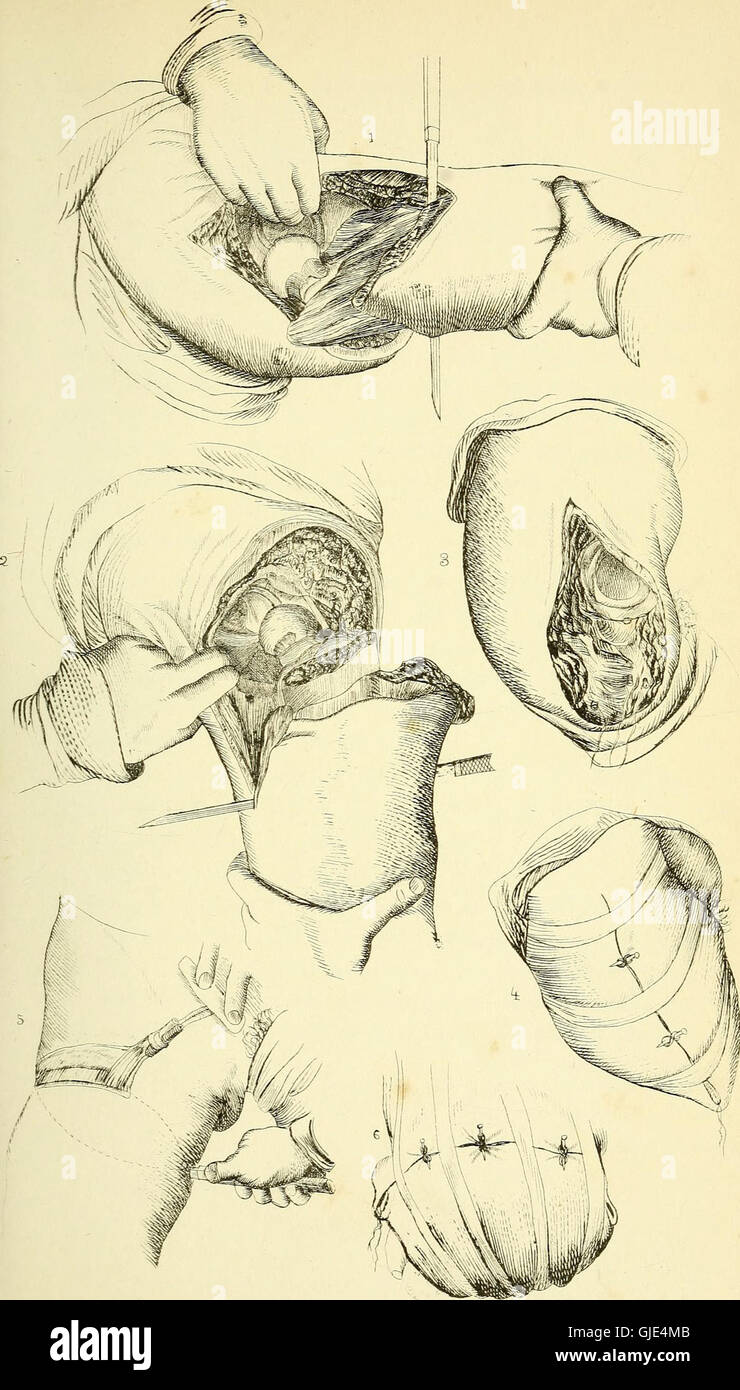 This medical text from 1852 presents detailed engravings and ...