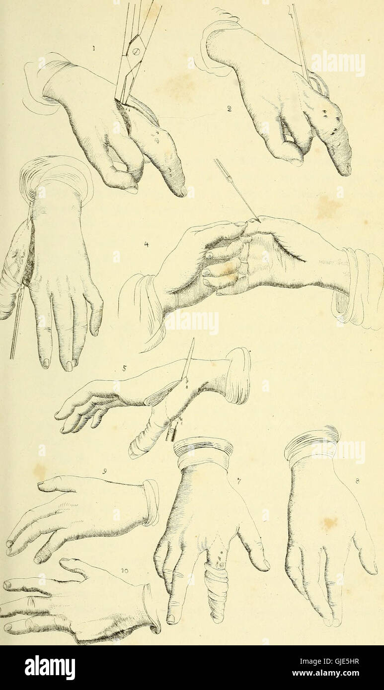 This medical text from 1852 provides a detailed guide to operative ...