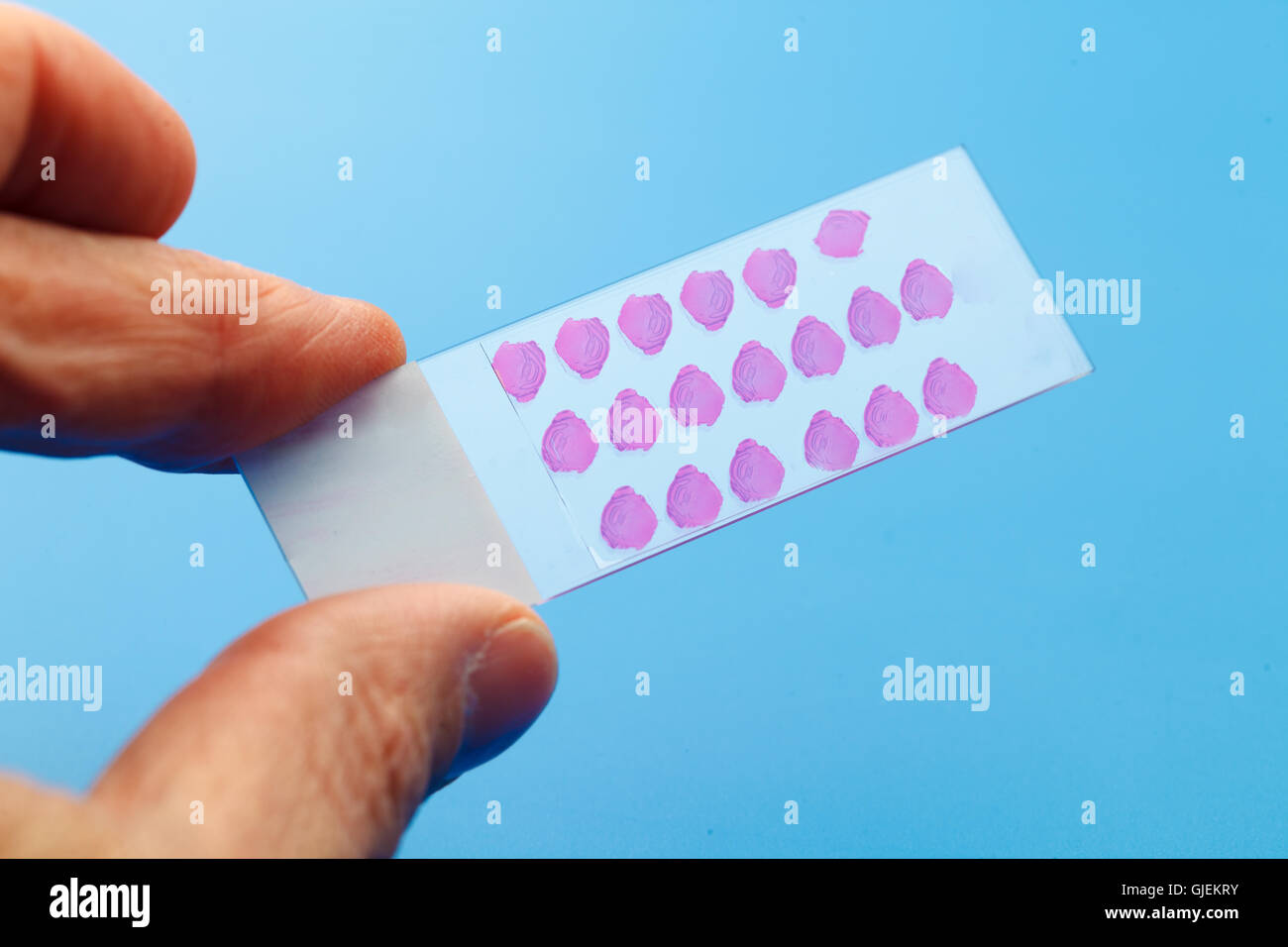 Microscope slide with biopsy samples Stock Photo - Alamy