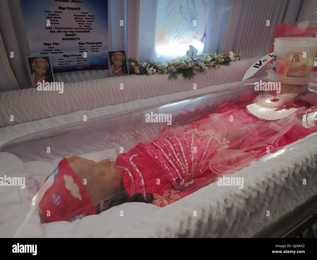 People With Progeria Lifespan