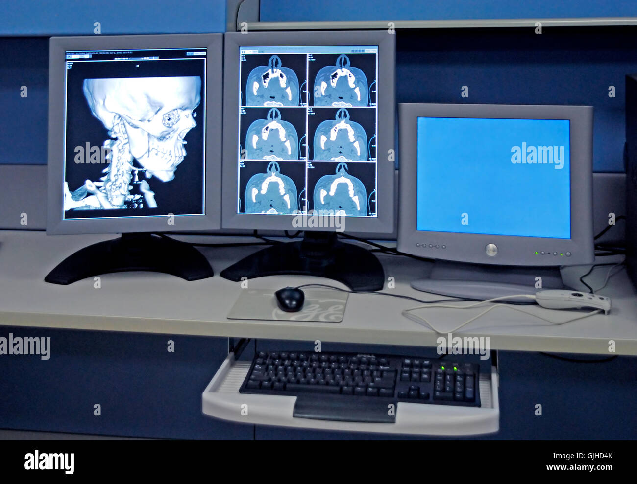 X rays hi-res stock photography and images - Alamy