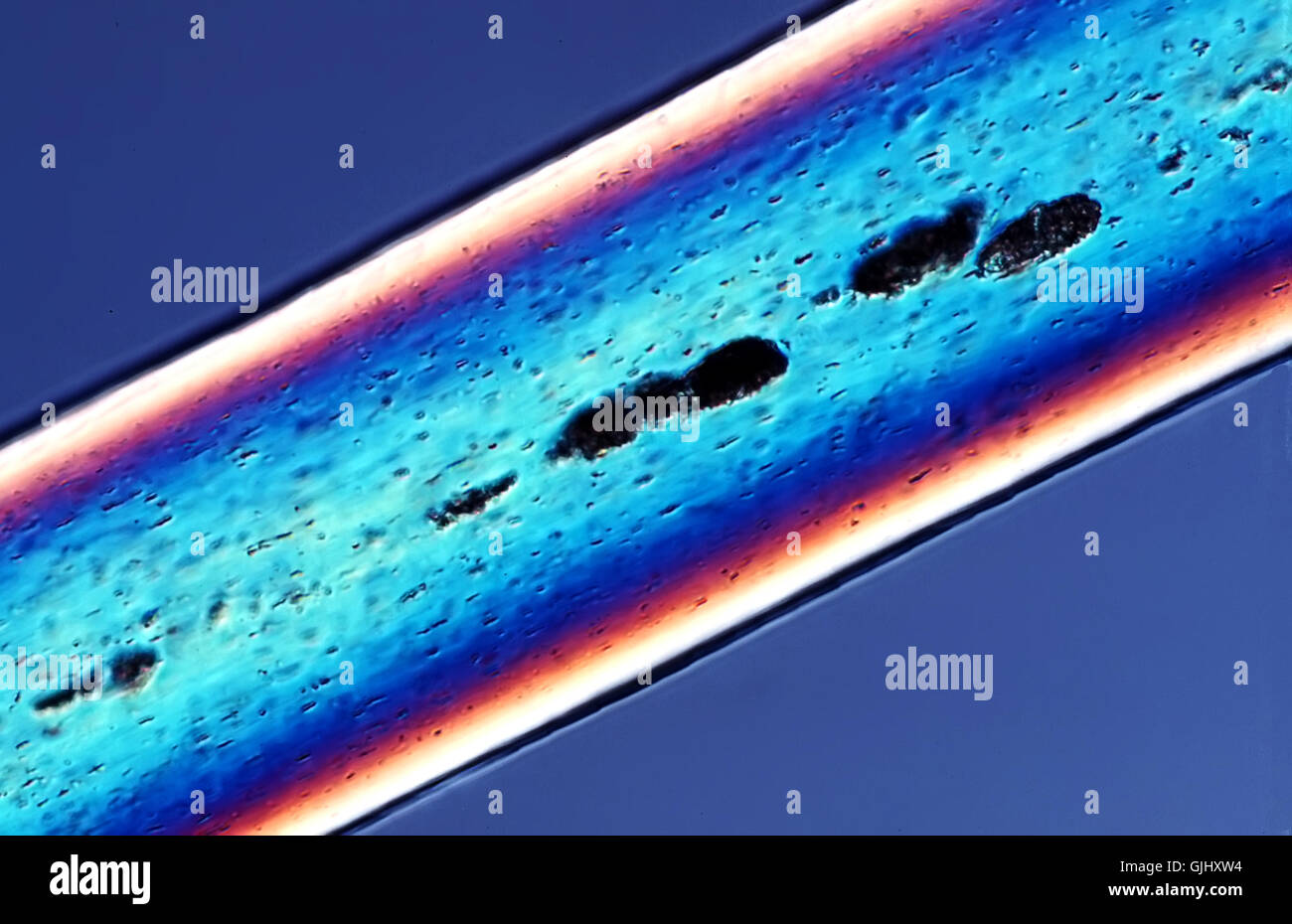 hair from human,microscopic Stock Photo - Alamy