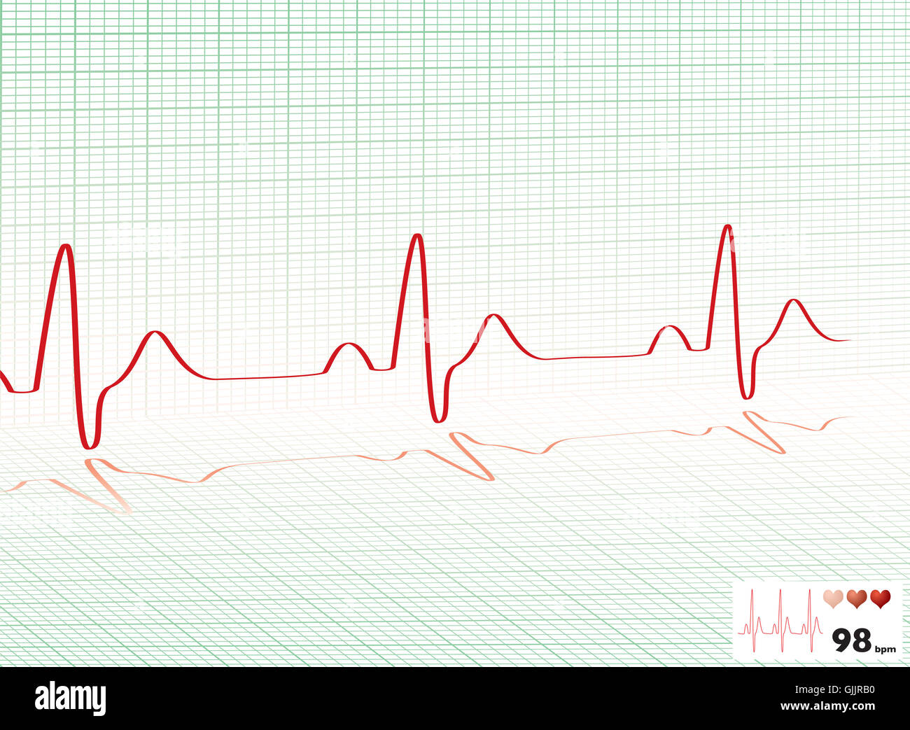 Ekg readout hi-res stock photography and images - Alamy