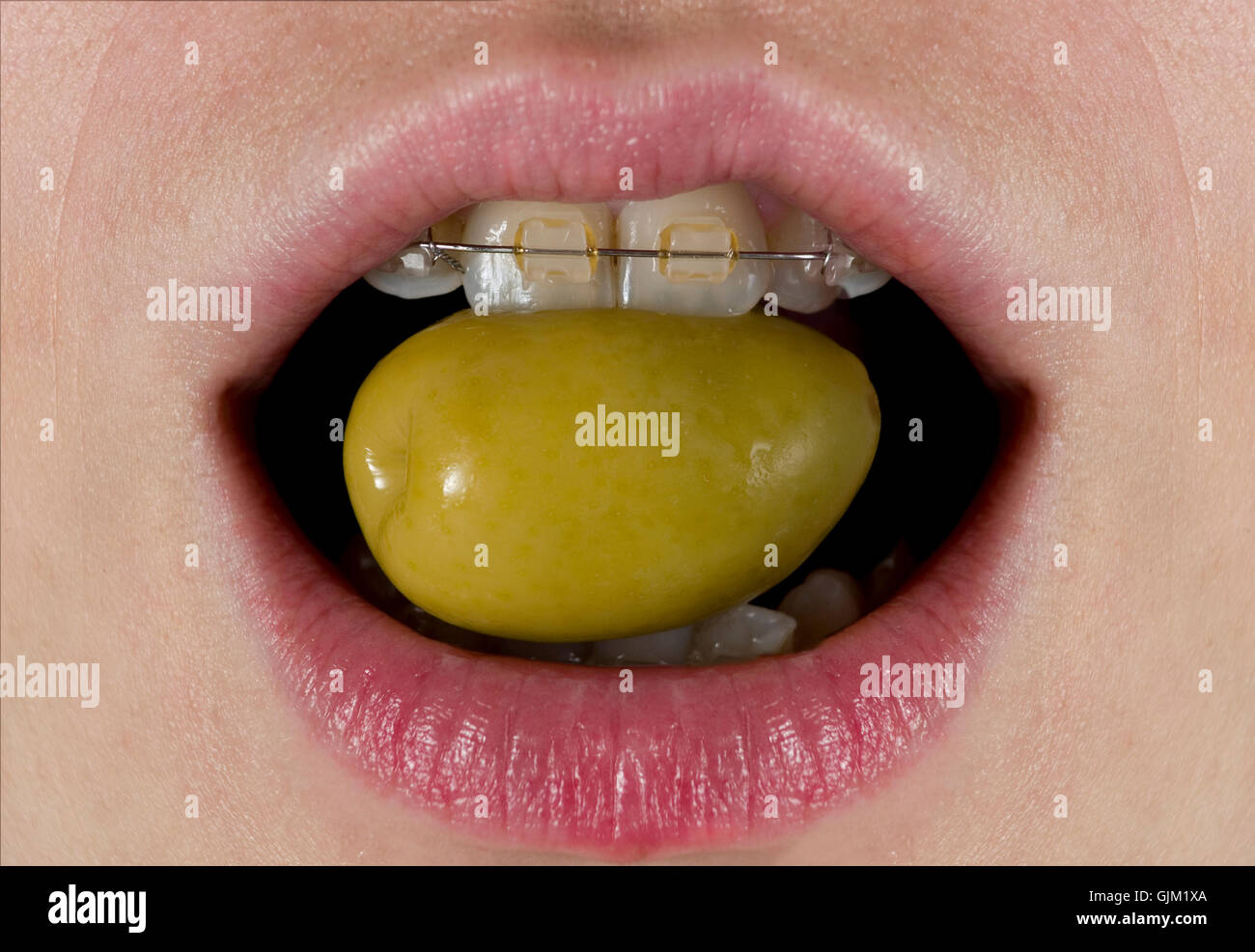 teeth lips metal Stock Photo - Alamy