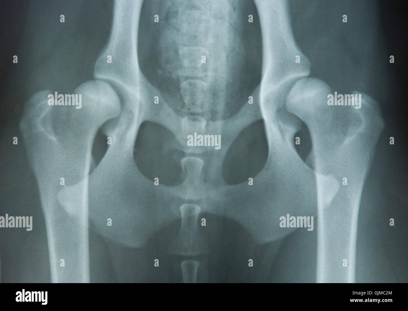 Hip dysplasia hi-res stock photography and images - Alamy