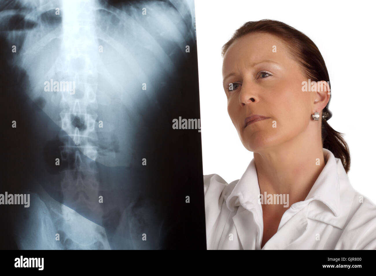 doctor with xray Stock Photo - Alamy