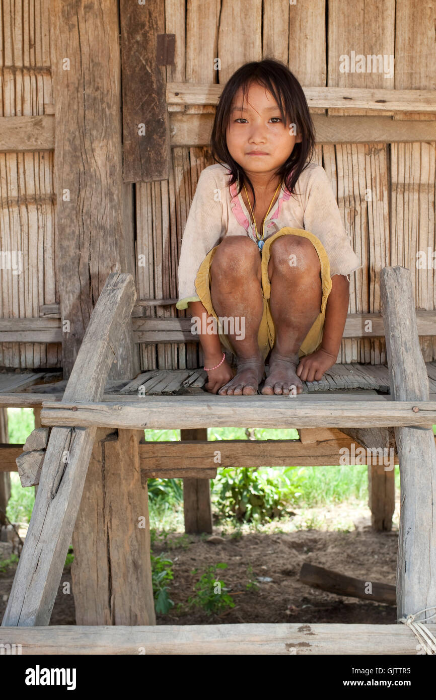 Poor hygiene hi-res stock photography and images - Alamy