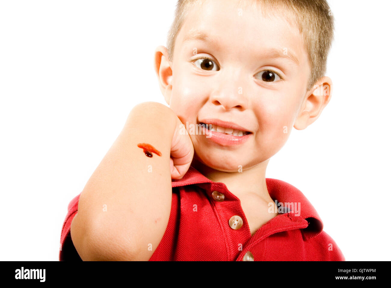 Injured youth hi-res stock photography and images - Alamy