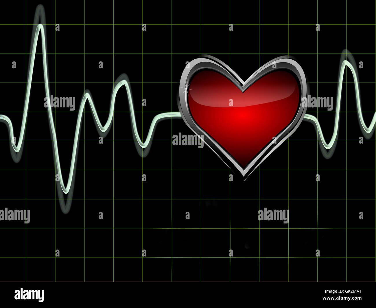 Heart defect hi-res stock photography and images - Alamy