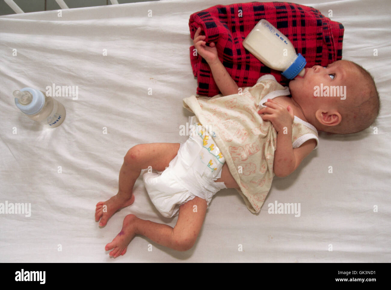 Indian aids hi-res stock photography and images - Alamy