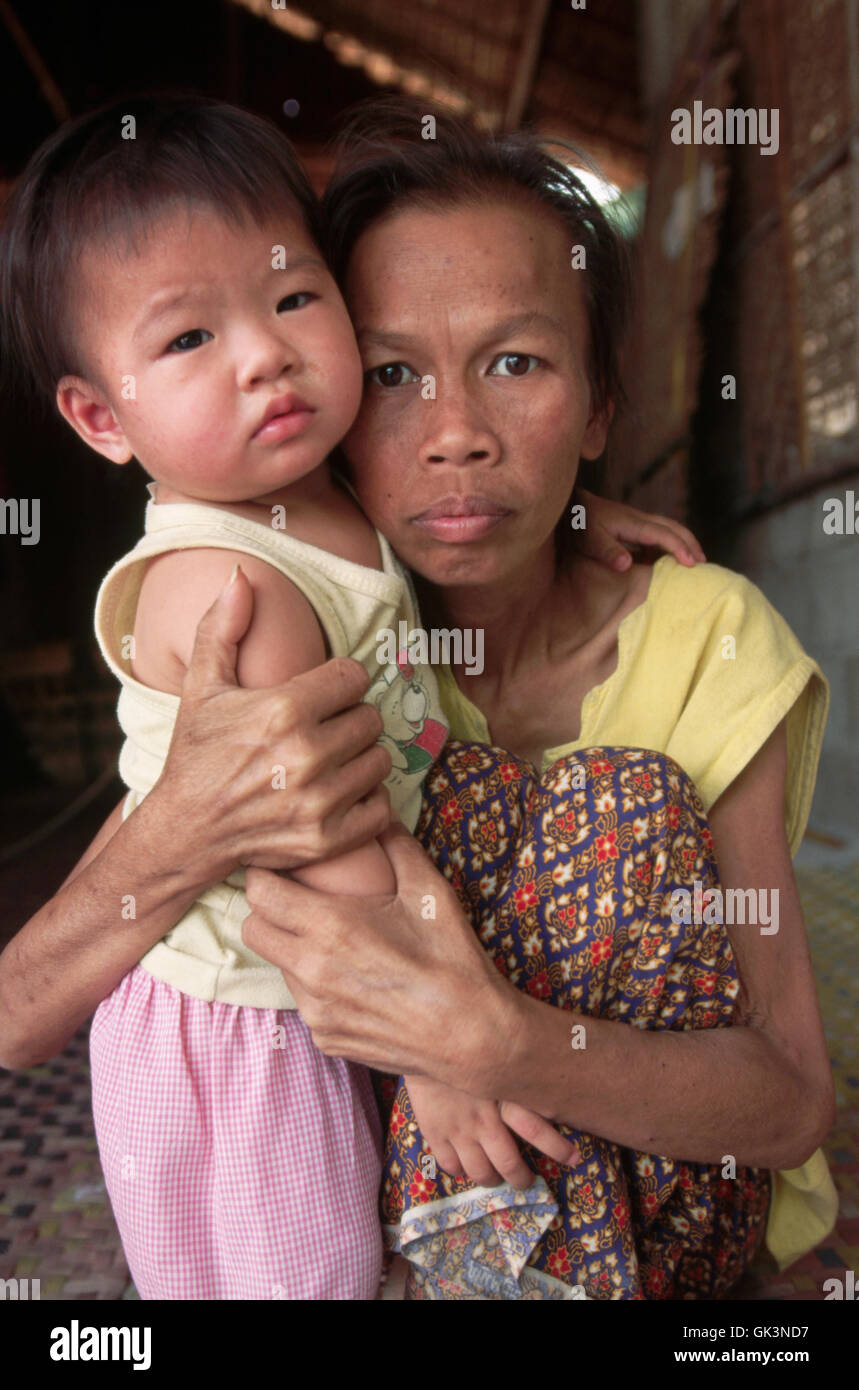 Aids child thailand hi-res stock photography and images - Alamy