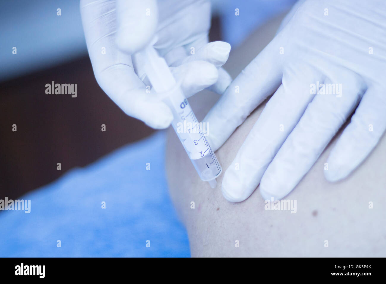 Intratissue Percutaneous Electrolysis EPI with needle injection medical ...