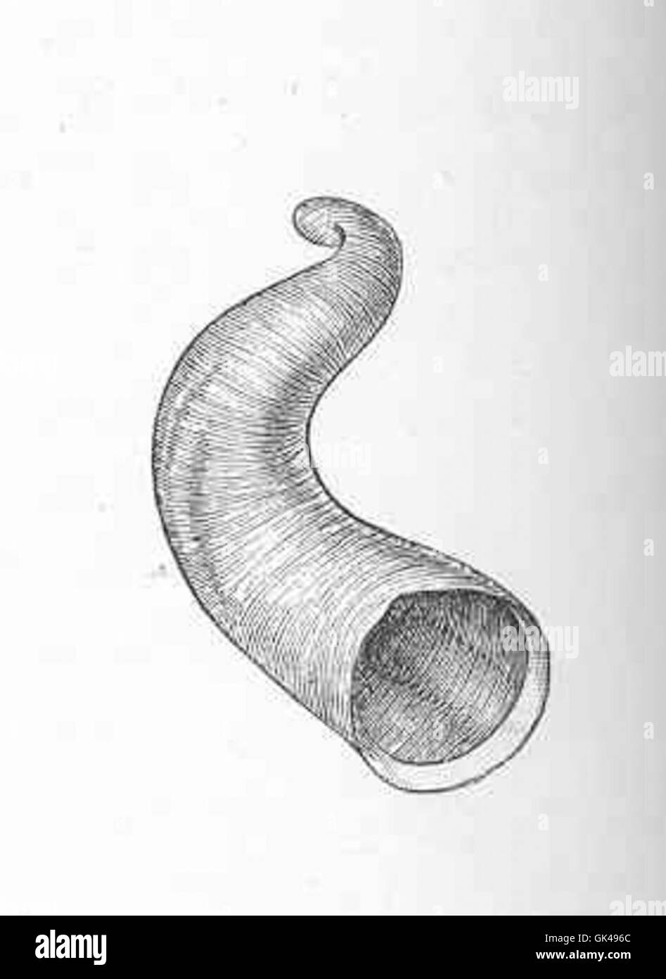 Anatomy malformation Black and White Stock Photos & Images - Alamy