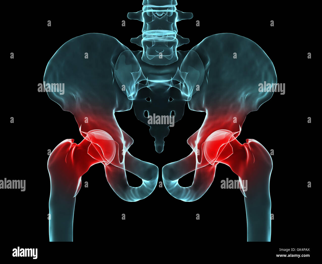 Human carcass hi-res stock photography and images - Alamy