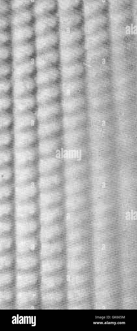 49922 Details of denticulation of a portion of the anterior median area ...