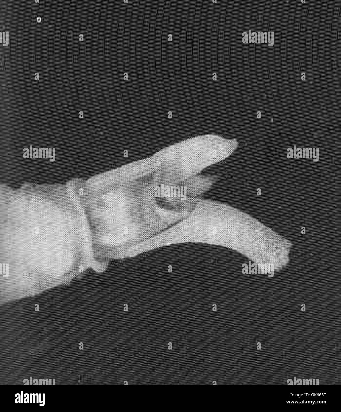 This image shows the siphonal end of *Teredo navalis*, a species of ...