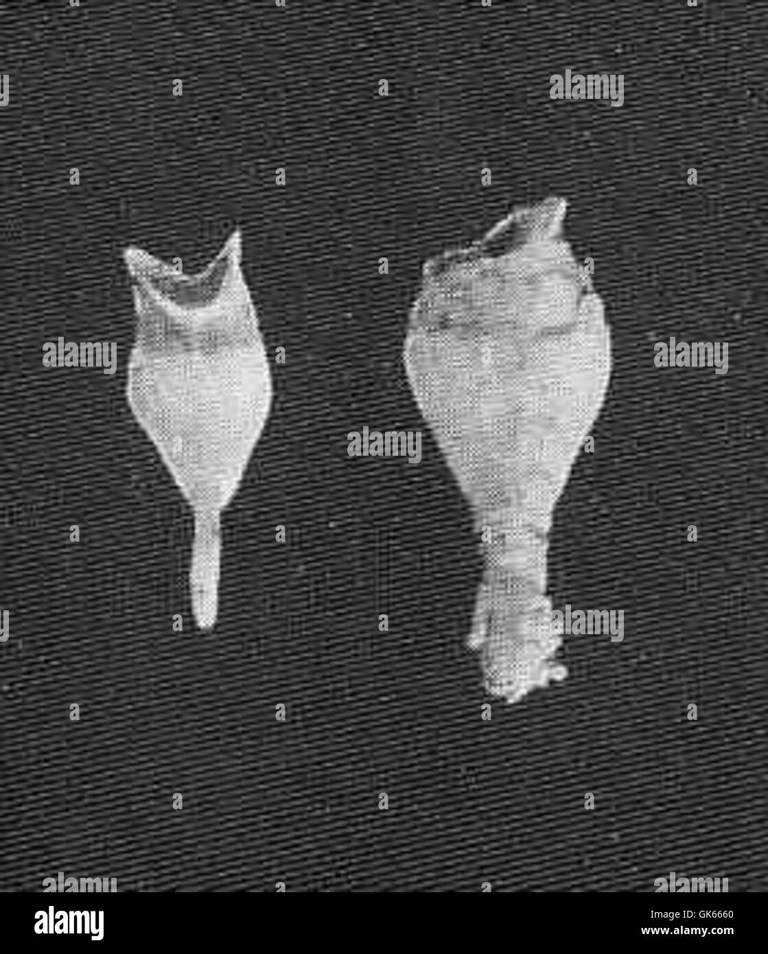 The image shows a comparison between a normal and an aged Teredo ...