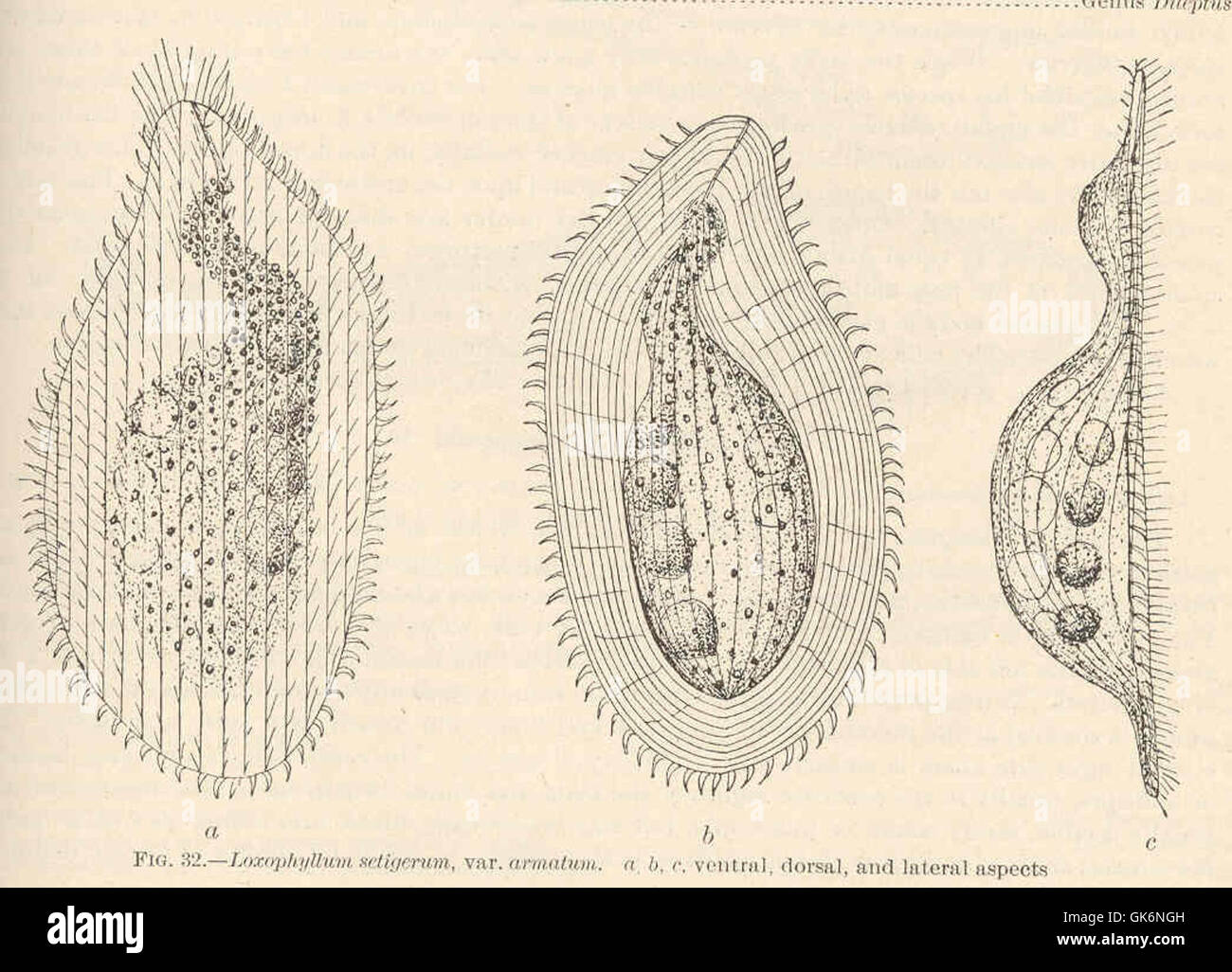 Loxophyllum setigerum, var. armatum is a species of ciliate protozoan ...