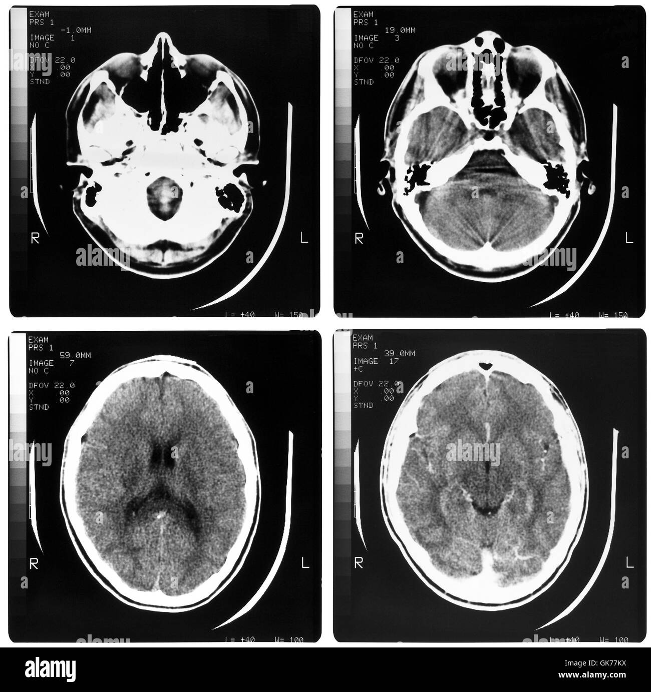 Cure x Black and White Stock Photos & Images - Alamy