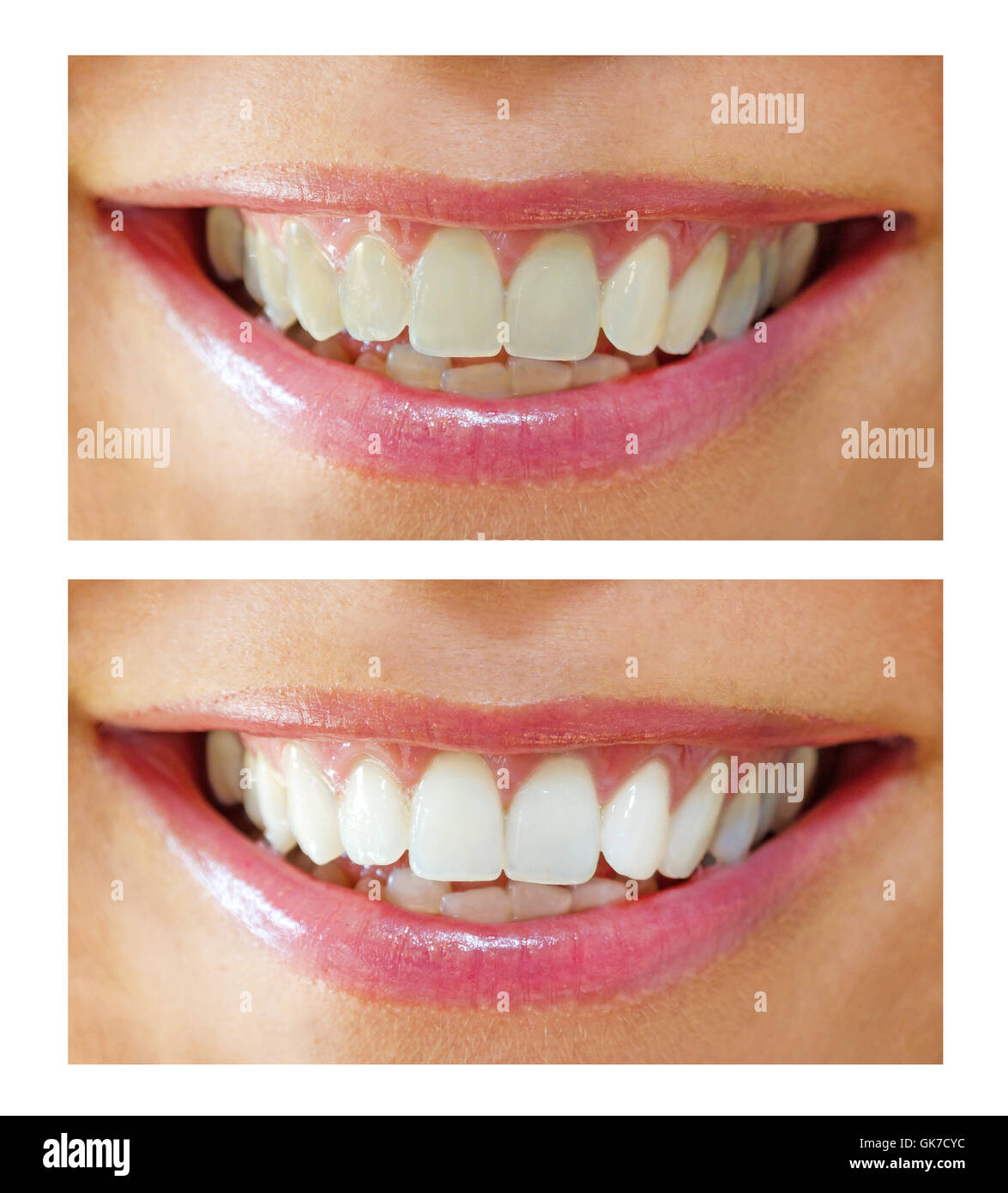 Mouth with teeth Cut Out Stock Images & Pictures - Alamy