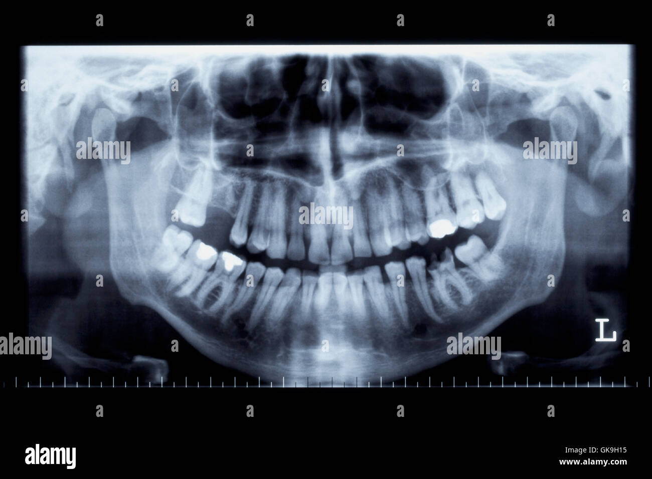 Human Jaw Bone High Resolution Stock Photography and Images - Alamy