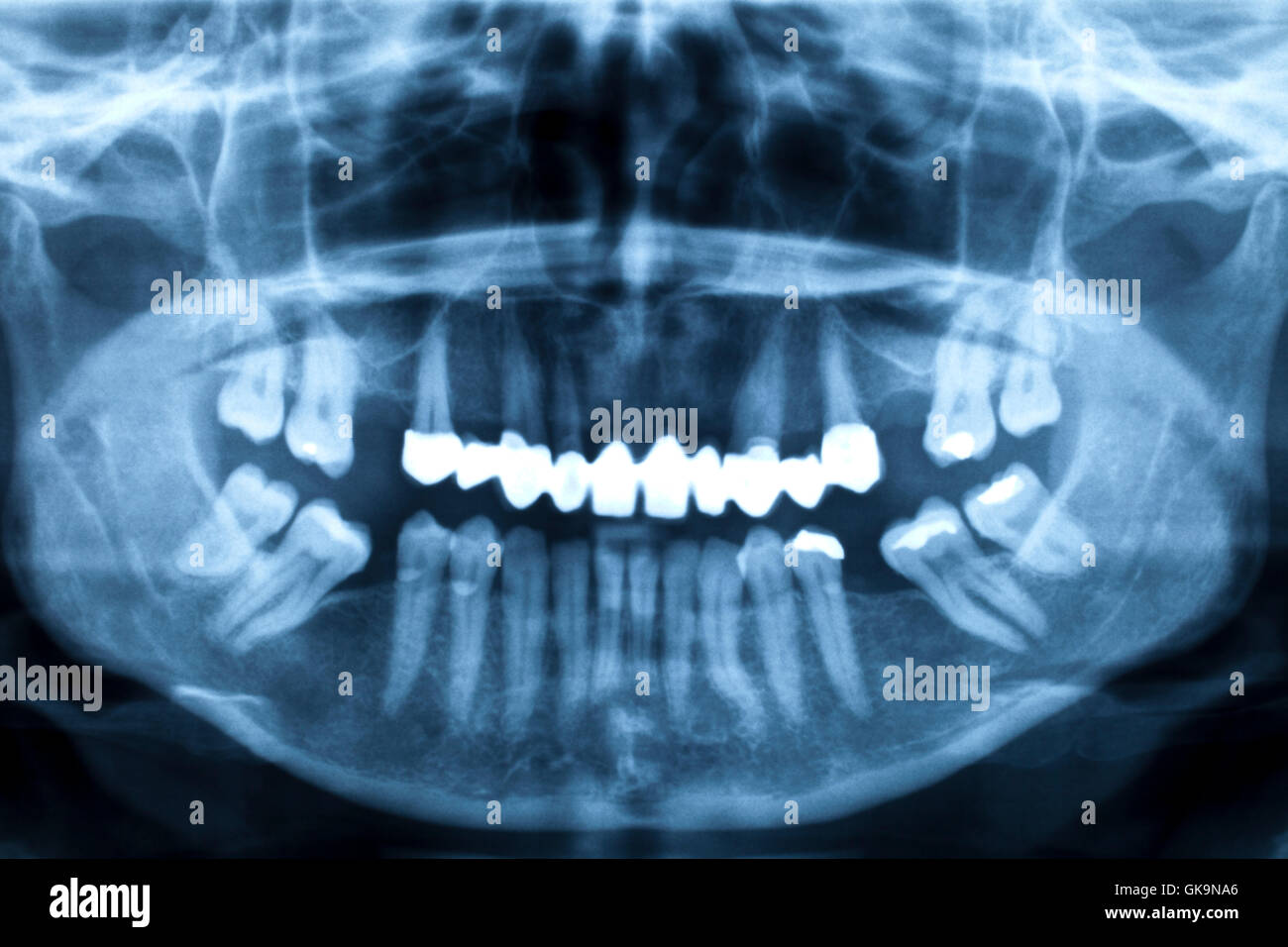Bad teeth hi-res stock photography and images - Alamy