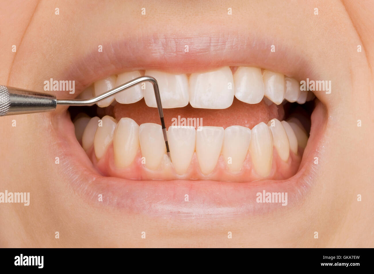 teeth dentist tooth Stock Photo - Alamy