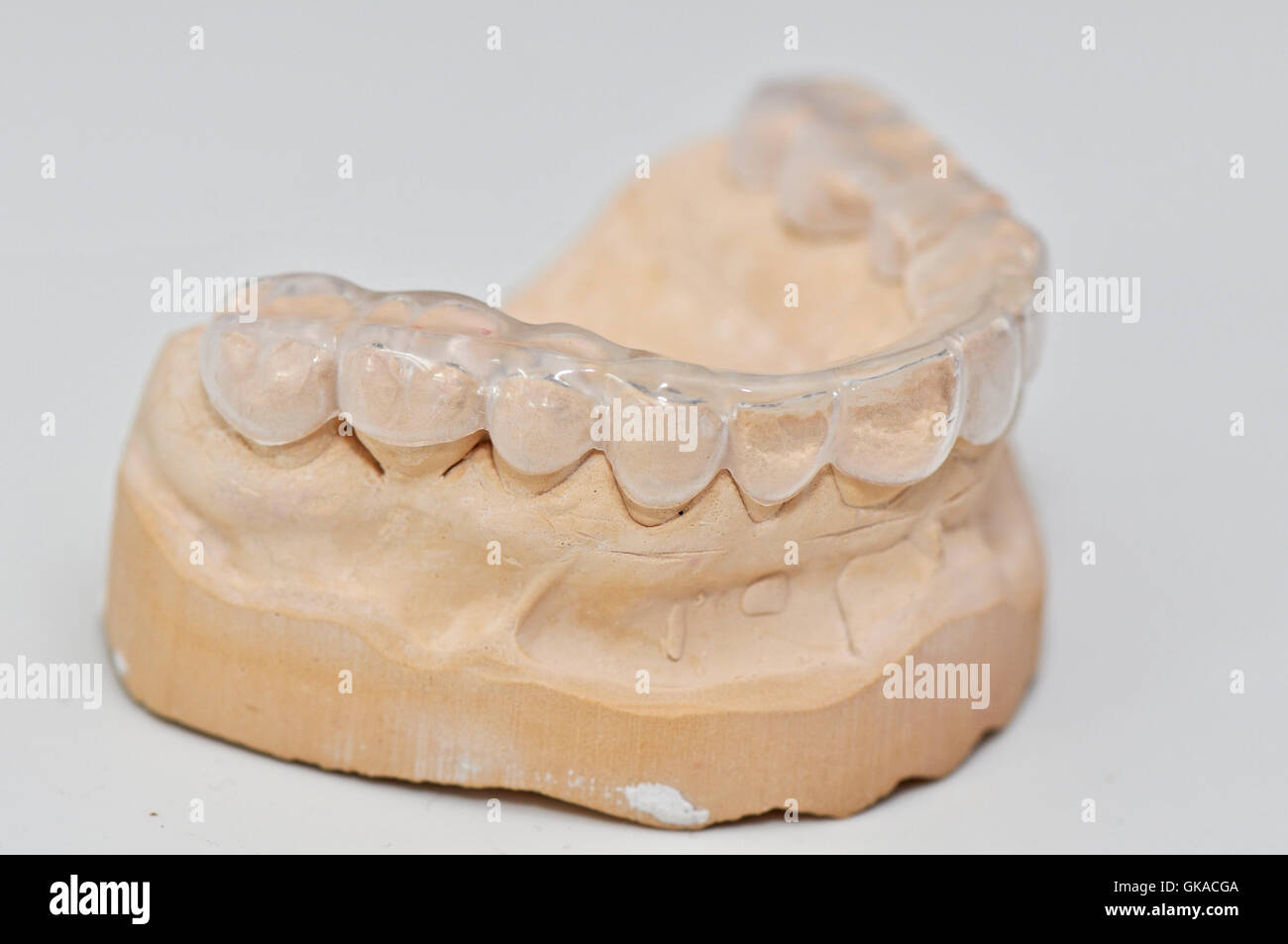 Correct bite of teeth hi-res stock photography and images - Alamy