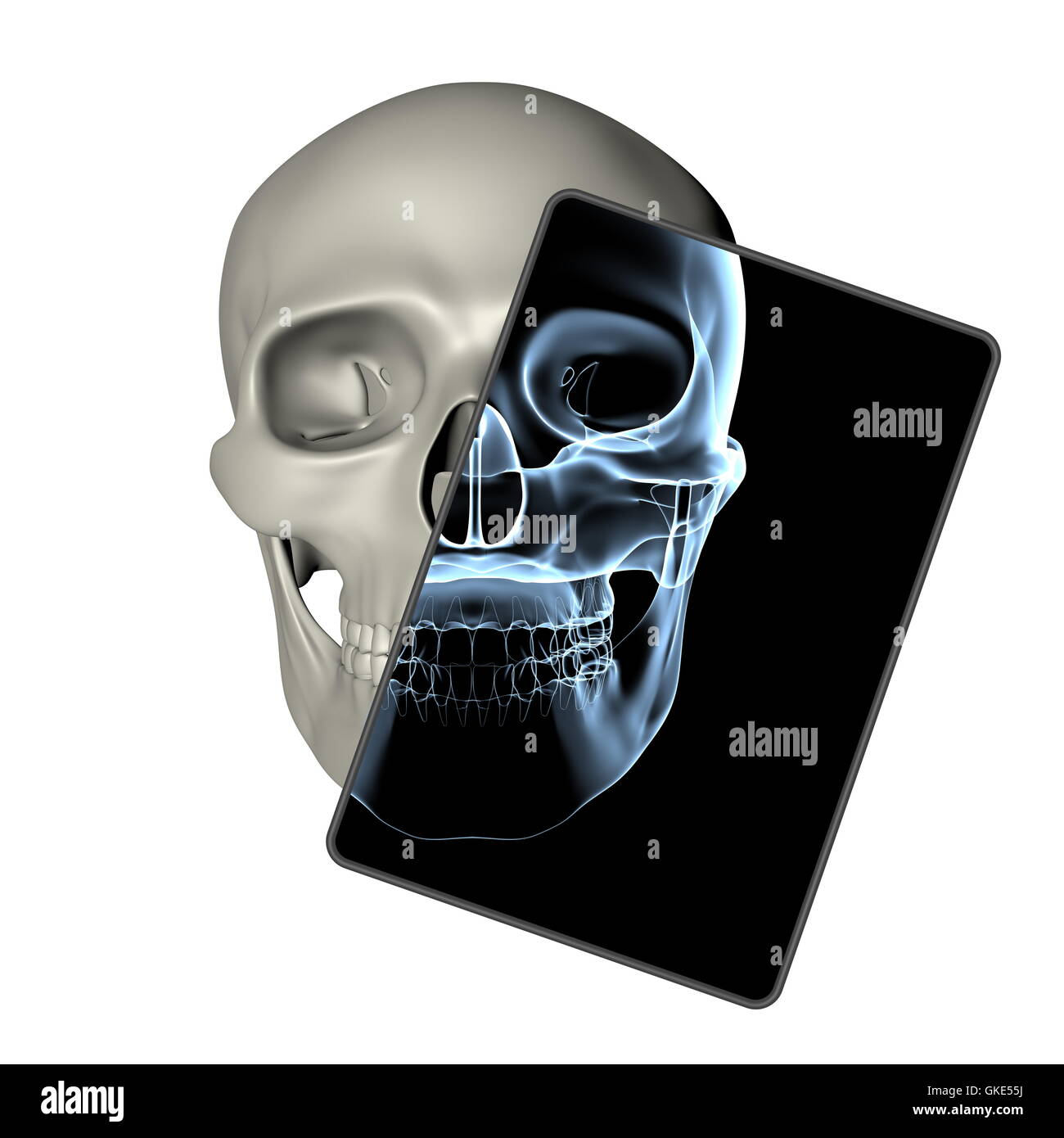 Skull ray image head Cut Out Stock Images & Pictures - Alamy