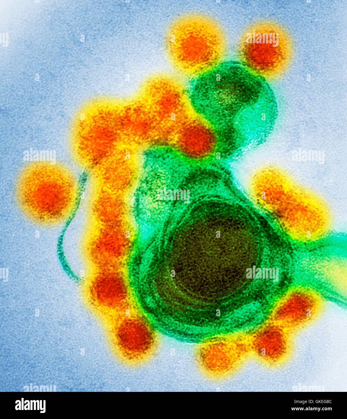 Coloured transmission electron micrograph hi-res stock photography and ...