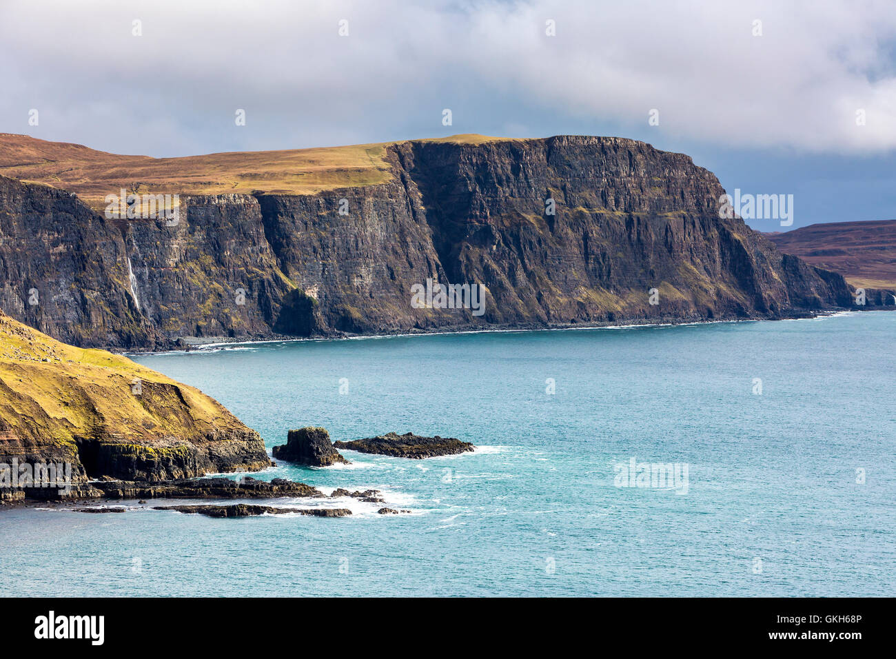 Waterstein head hi-res stock photography and images - Alamy