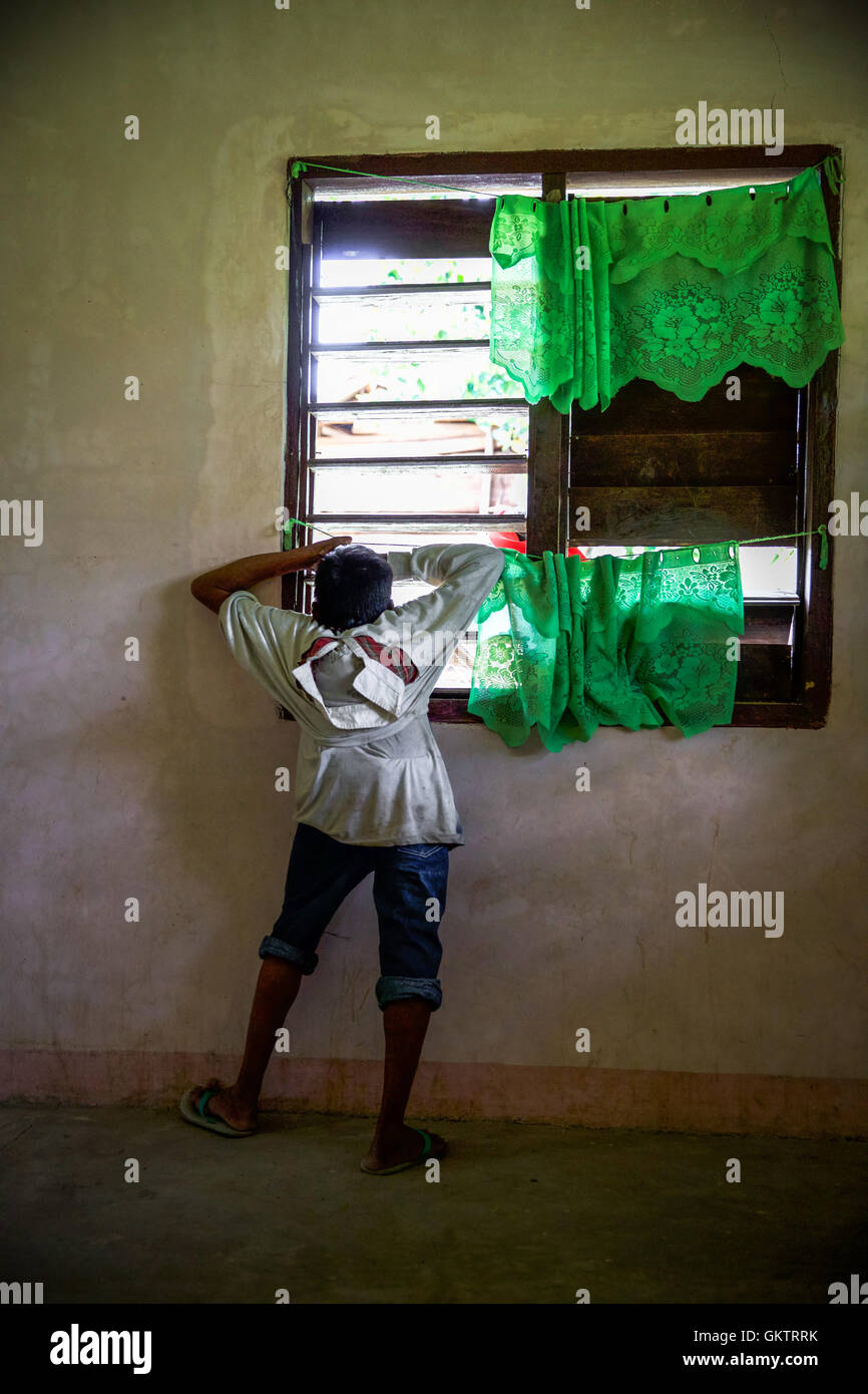 Kyphosis hi-res stock photography and images - Alamy