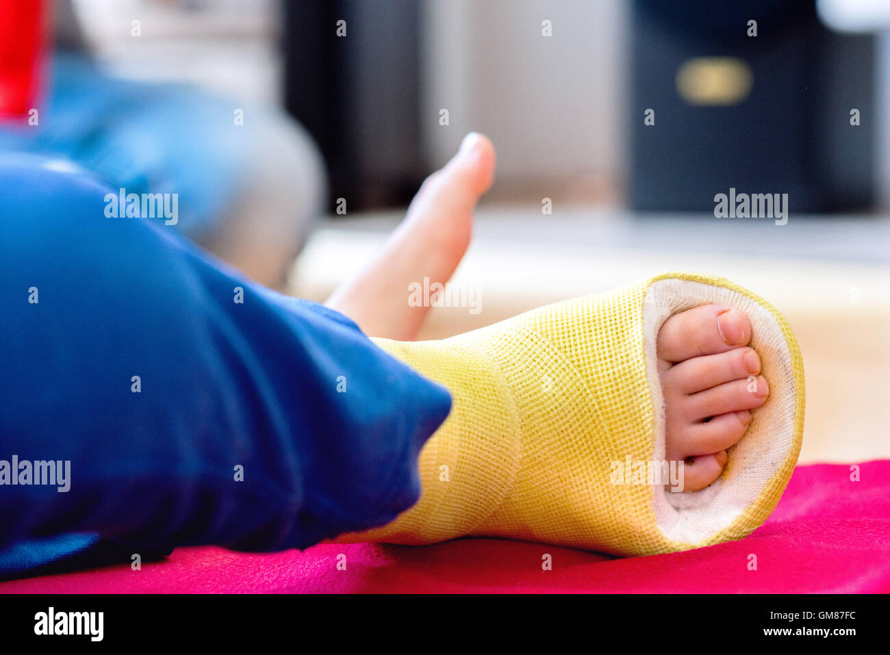 Boy leg in plaster cast hi-res stock photography and images - Alamy