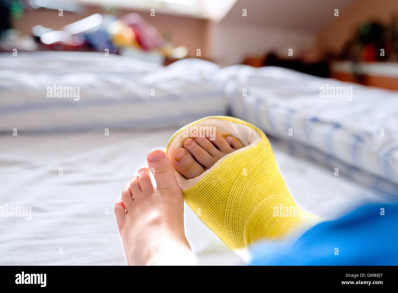Boy leg in plaster cast hi-res stock photography and images - Alamy
