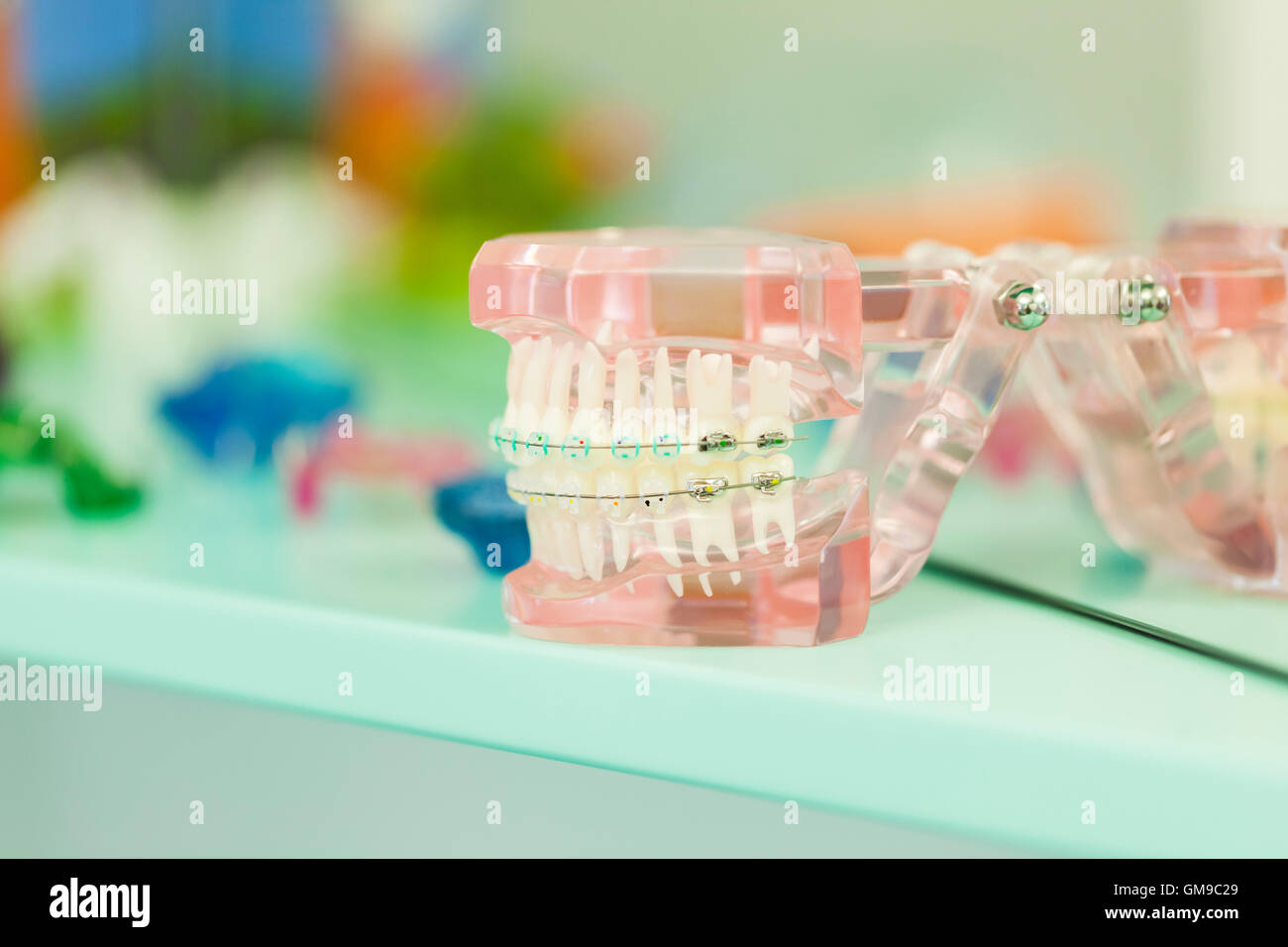Tooth model with braces Stock Photo - Alamy