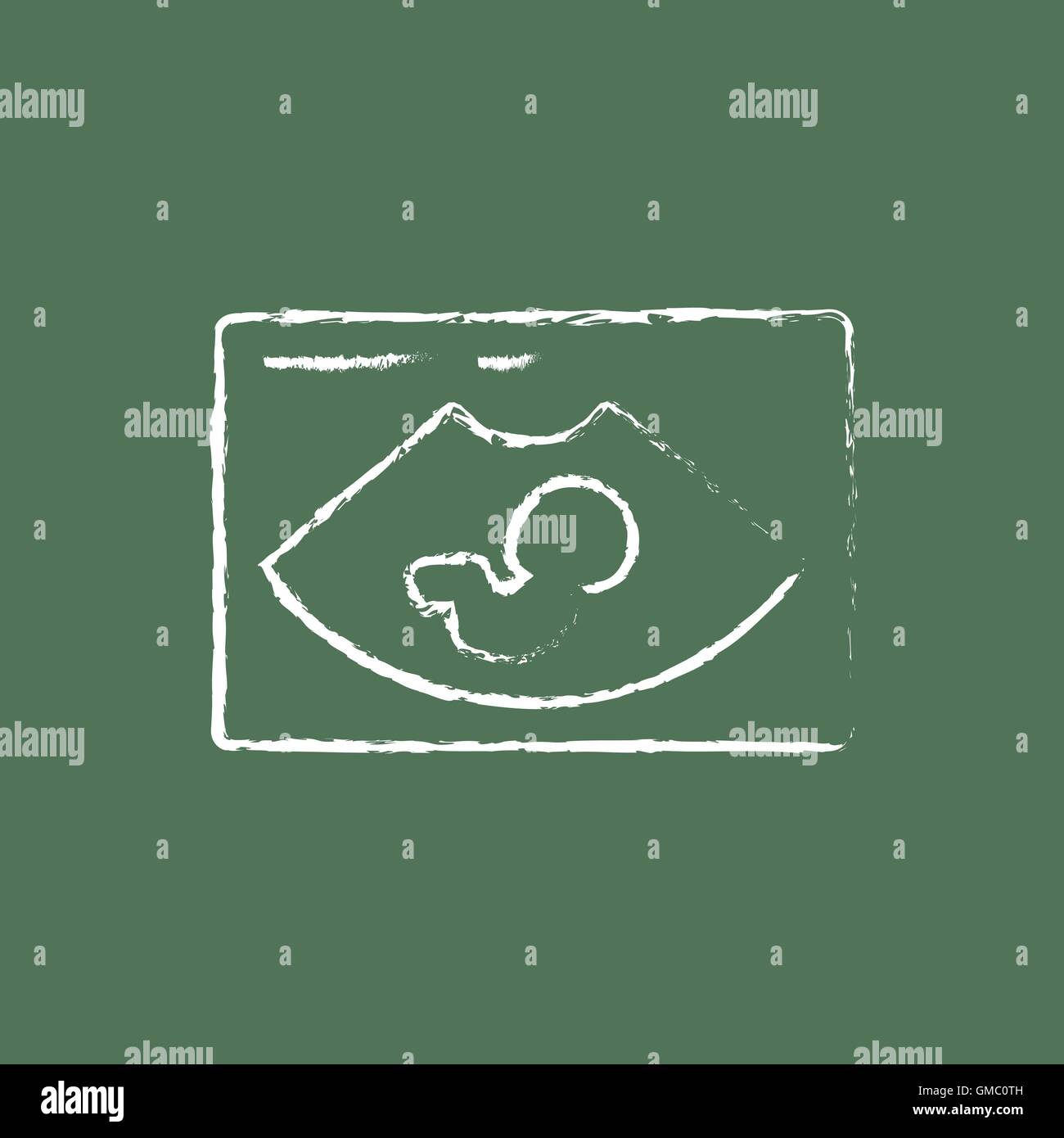 Ultrasound (sonogram) of fetus Stock Vector Images - Alamy