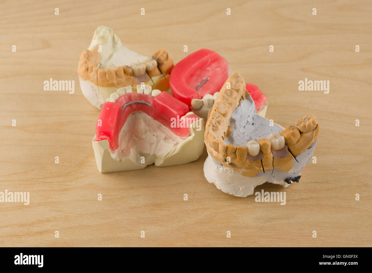 dental prosthesis manufacturing step in dental laboratories Stock Photo ...