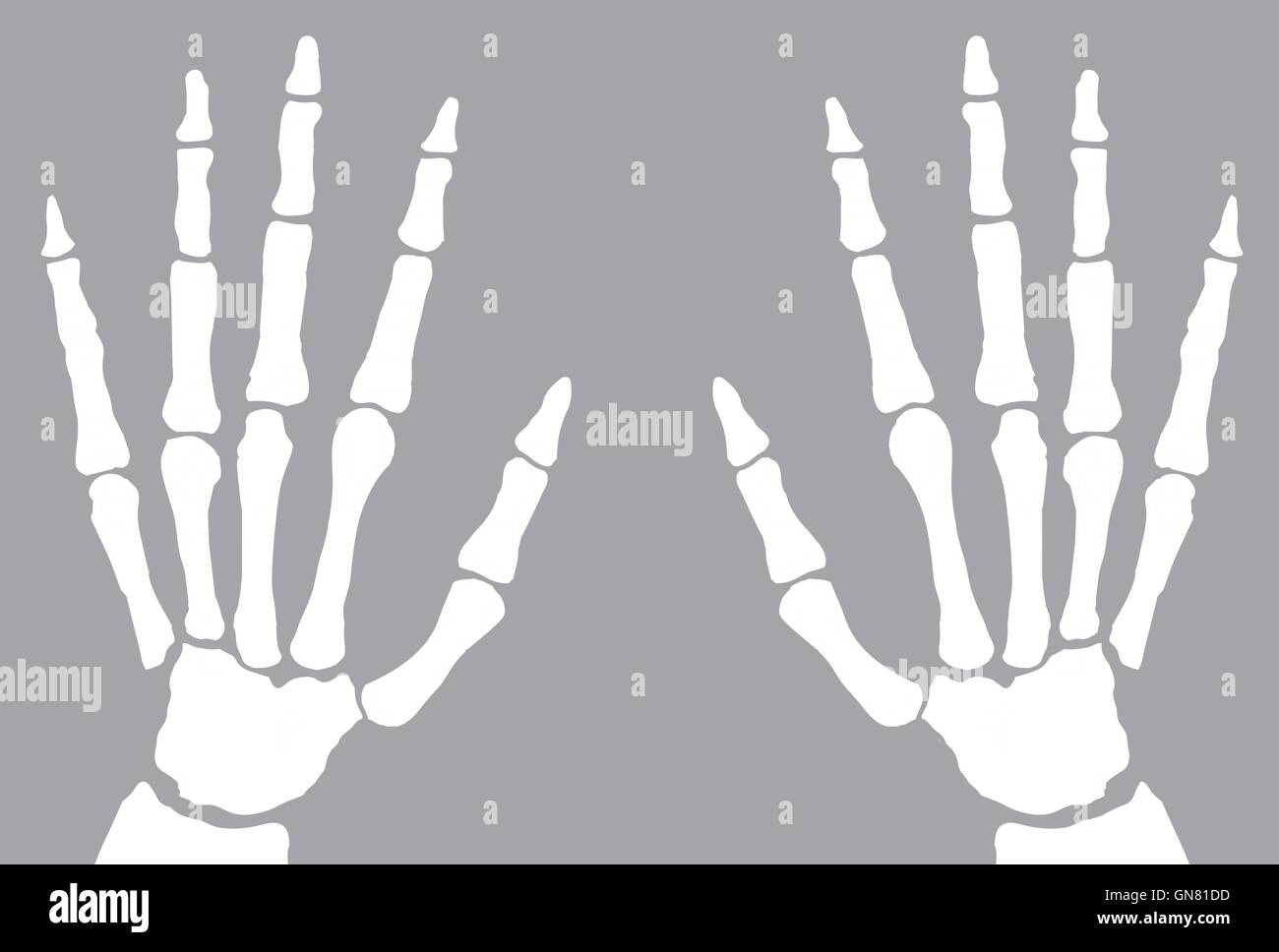Hand x ray hi-res stock photography and images - Alamy