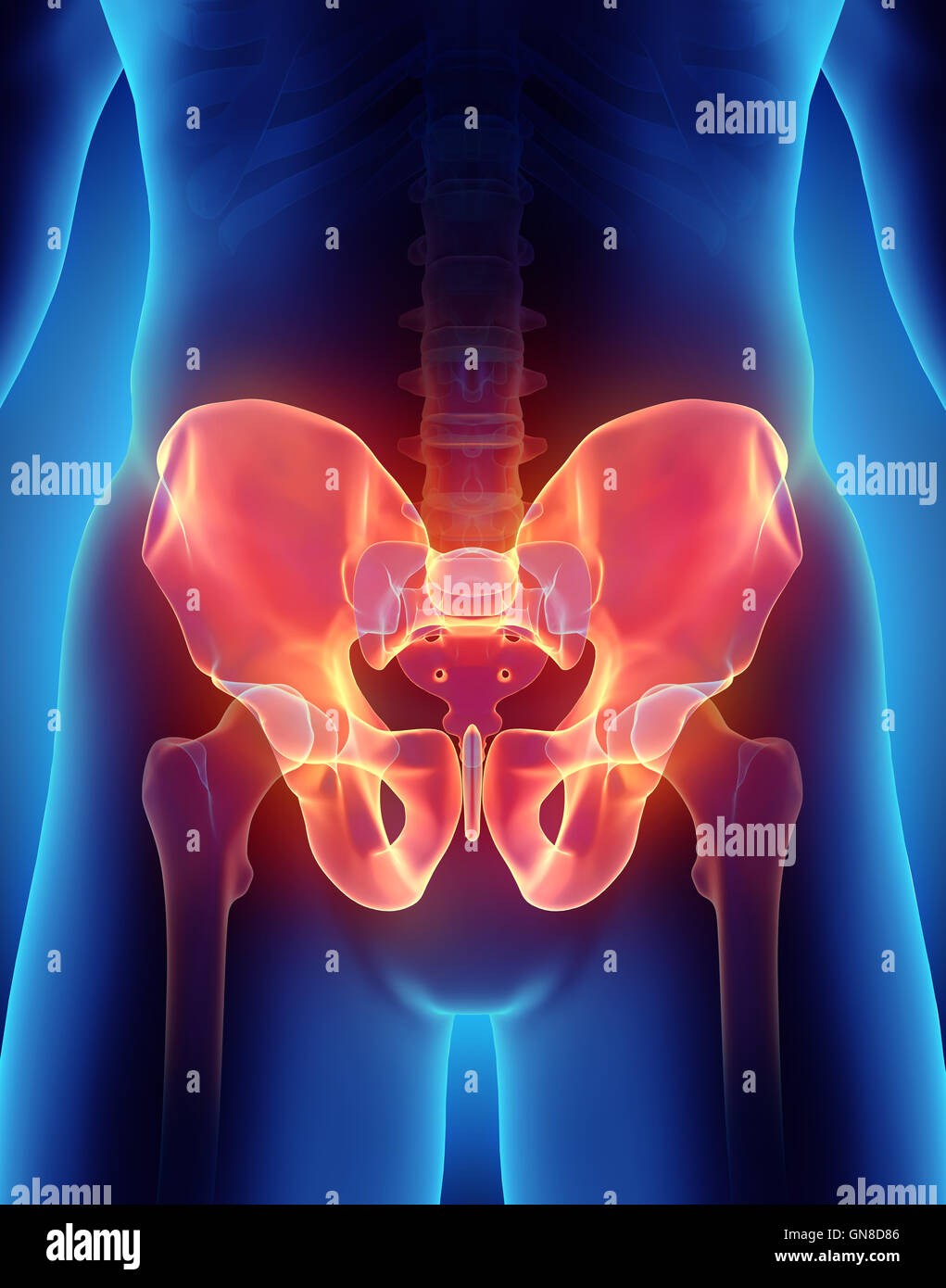 Broken hip bone xray hi-res stock photography and images - Alamy