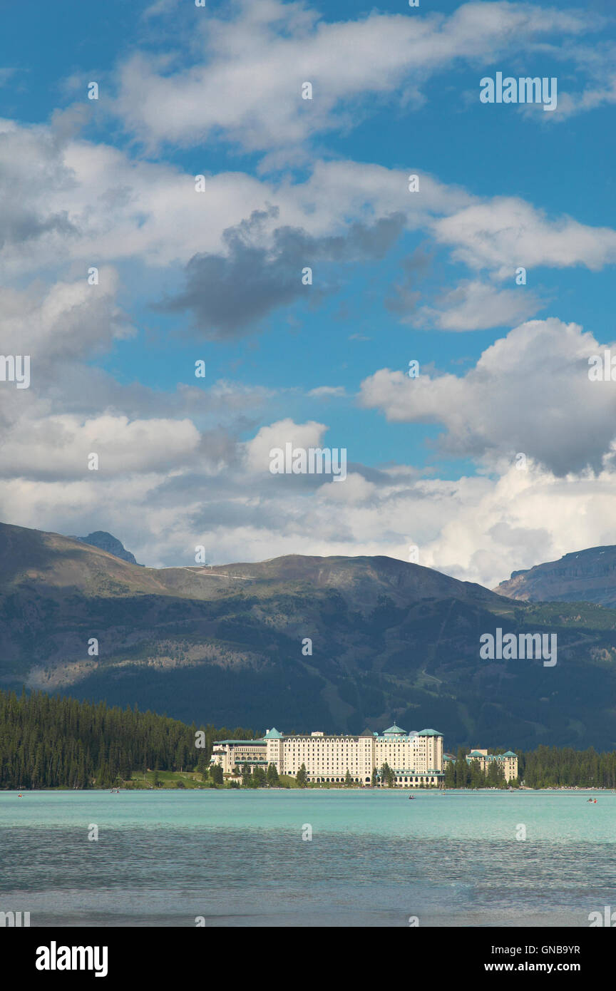 Canadian landscape in Lake Louise with hotel. Alberta. Canada. Vertical ...