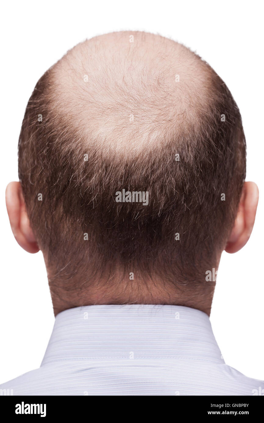 Bald man head Stock Photo - Alamy