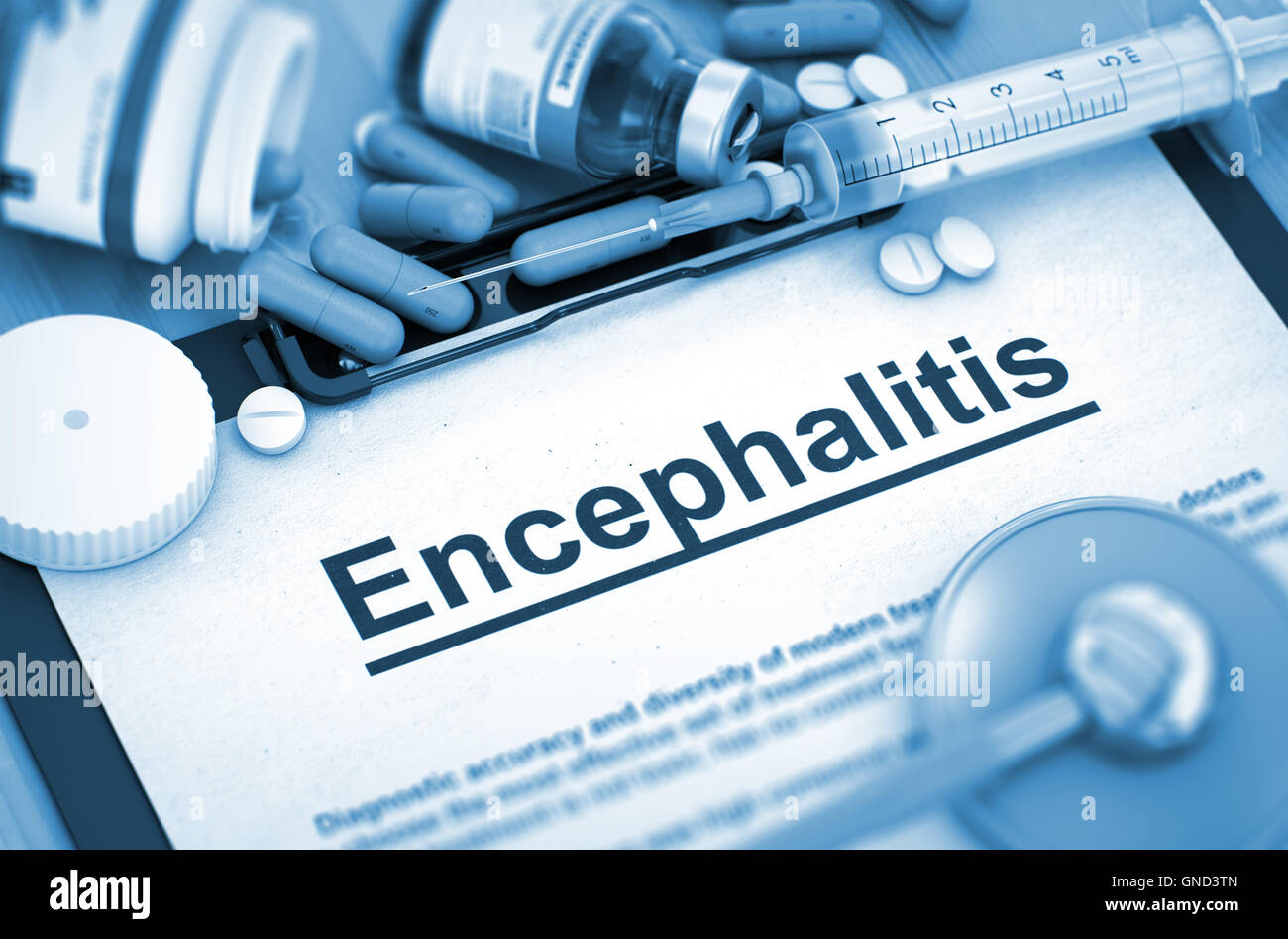 Encephalitis brain hi-res stock photography and images - Alamy