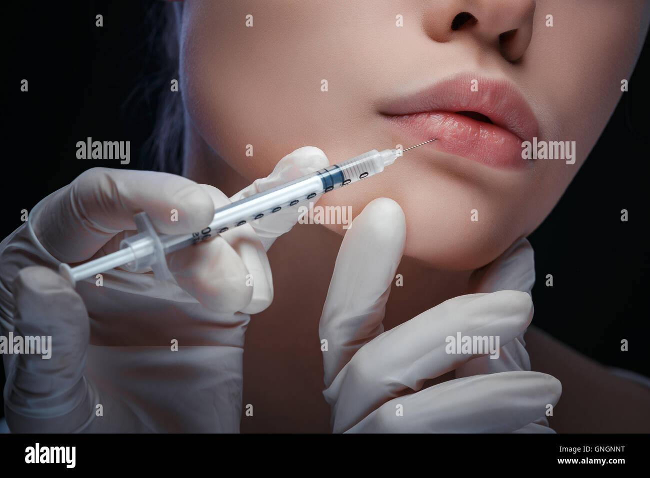 Plastic surgery cosmetic botox injection hi-res stock photography and ...